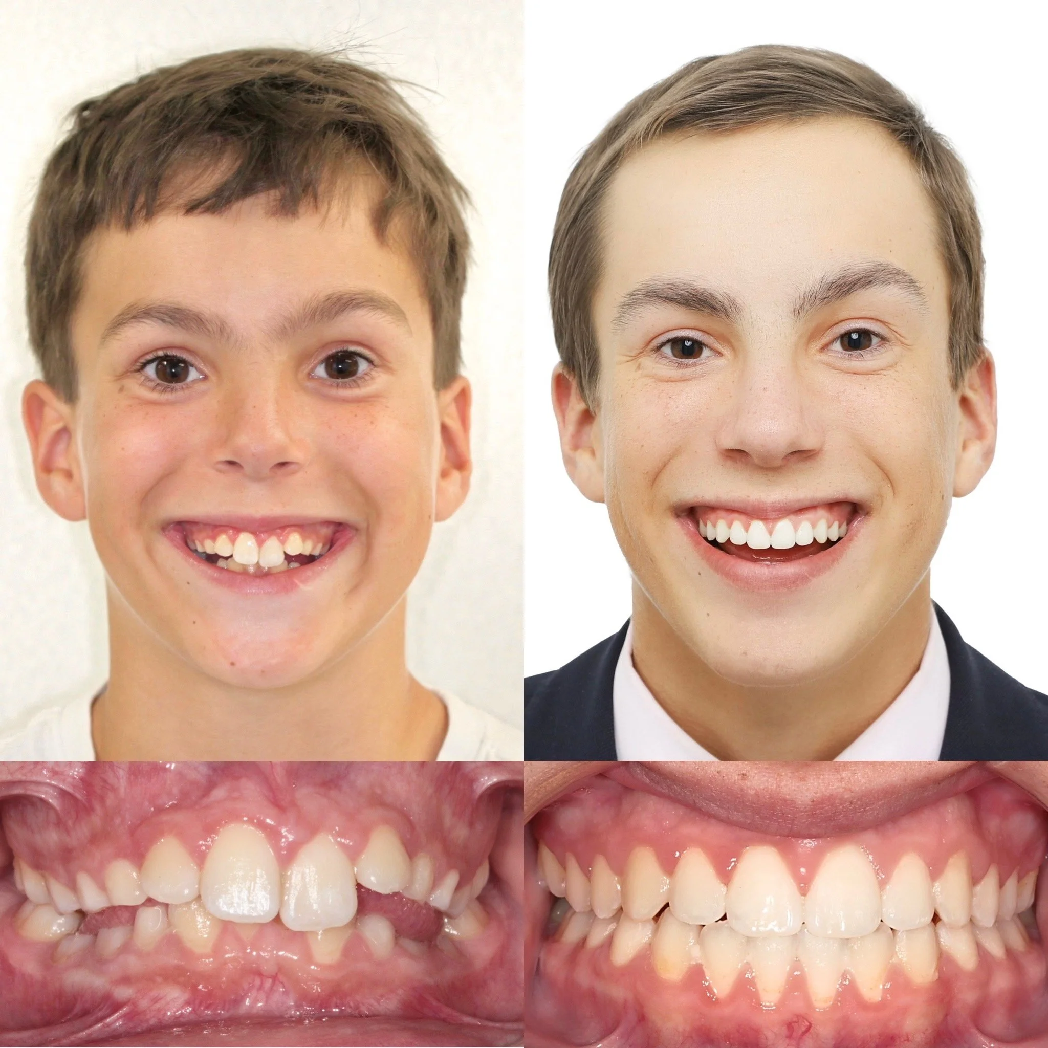 Maccaro Orthodontics in Garden City | Maccaro Smiles
