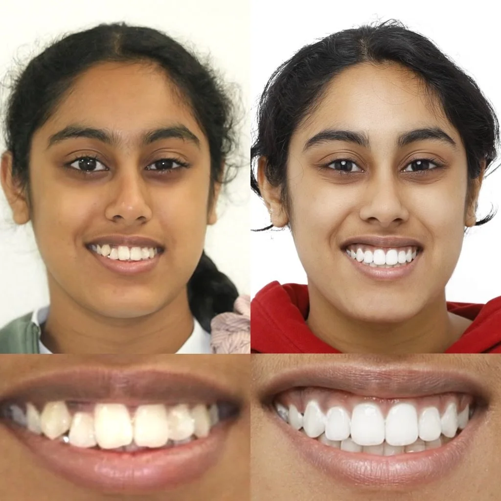 Maccaro Orthodontics in Garden City | Maccaro Smiles