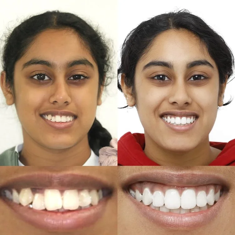 Maccaro Orthodontics in Garden City | Maccaro Smiles