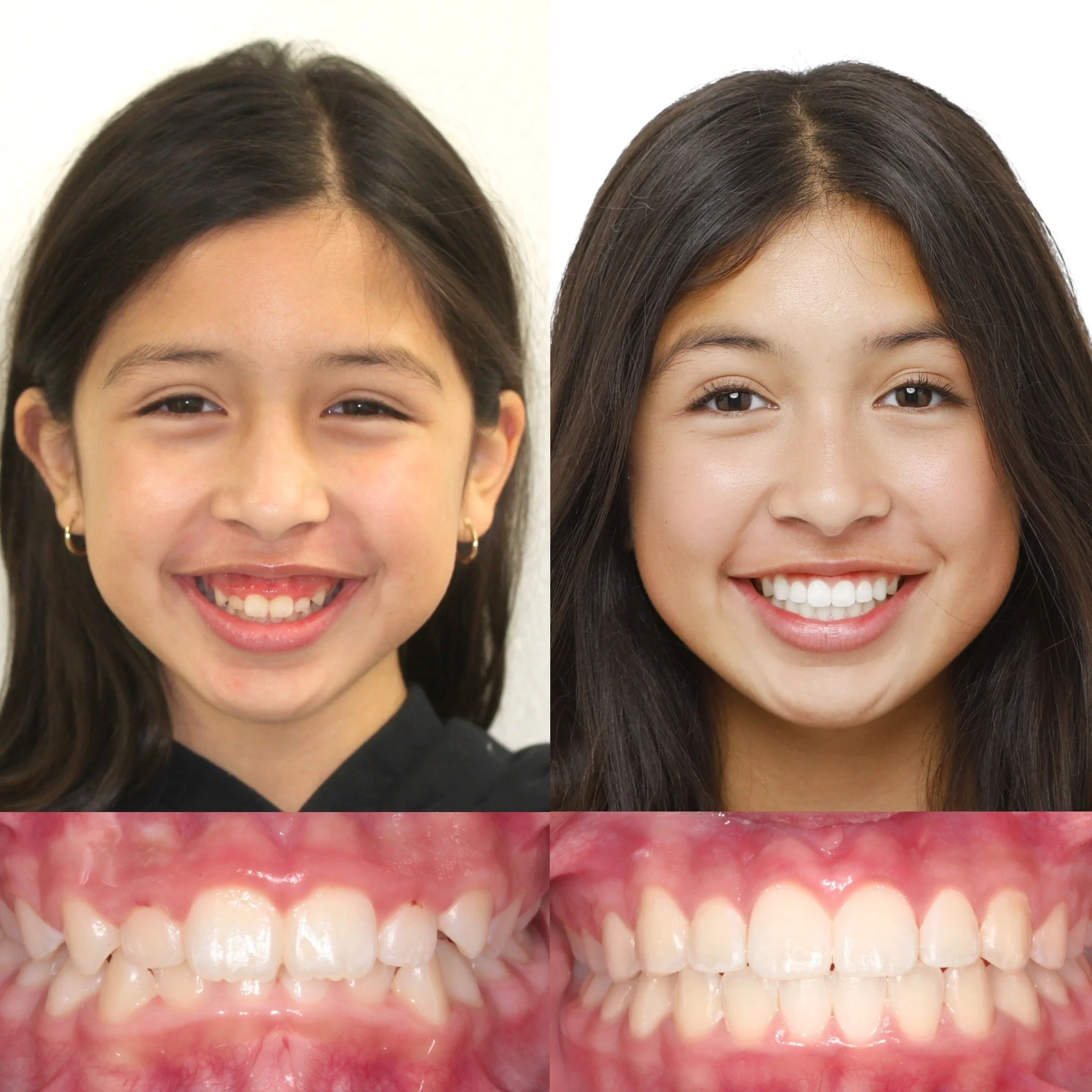 Maccaro Orthodontics in Garden City | Maccaro Smiles