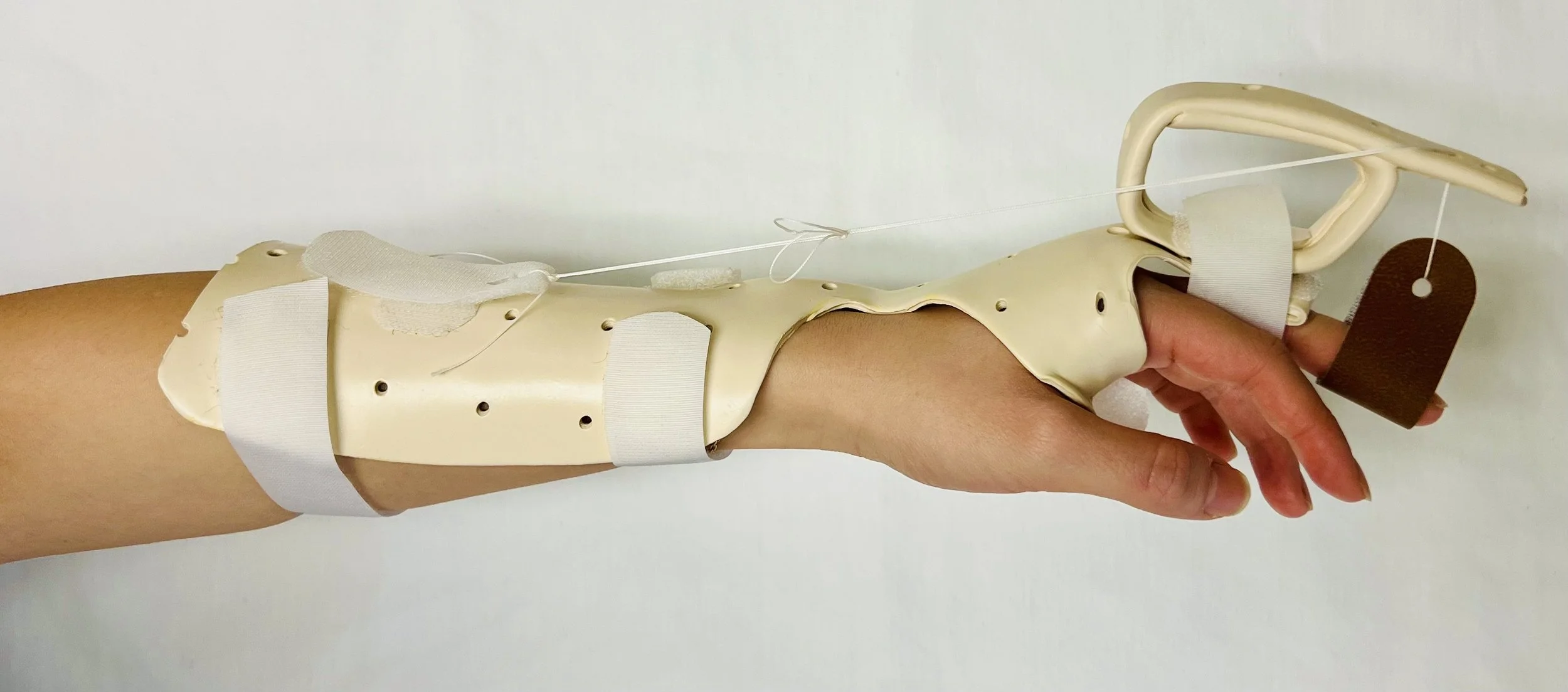 Certified Hand Therapist & Splinting, hiring, fellowship, CHT, IMS ...