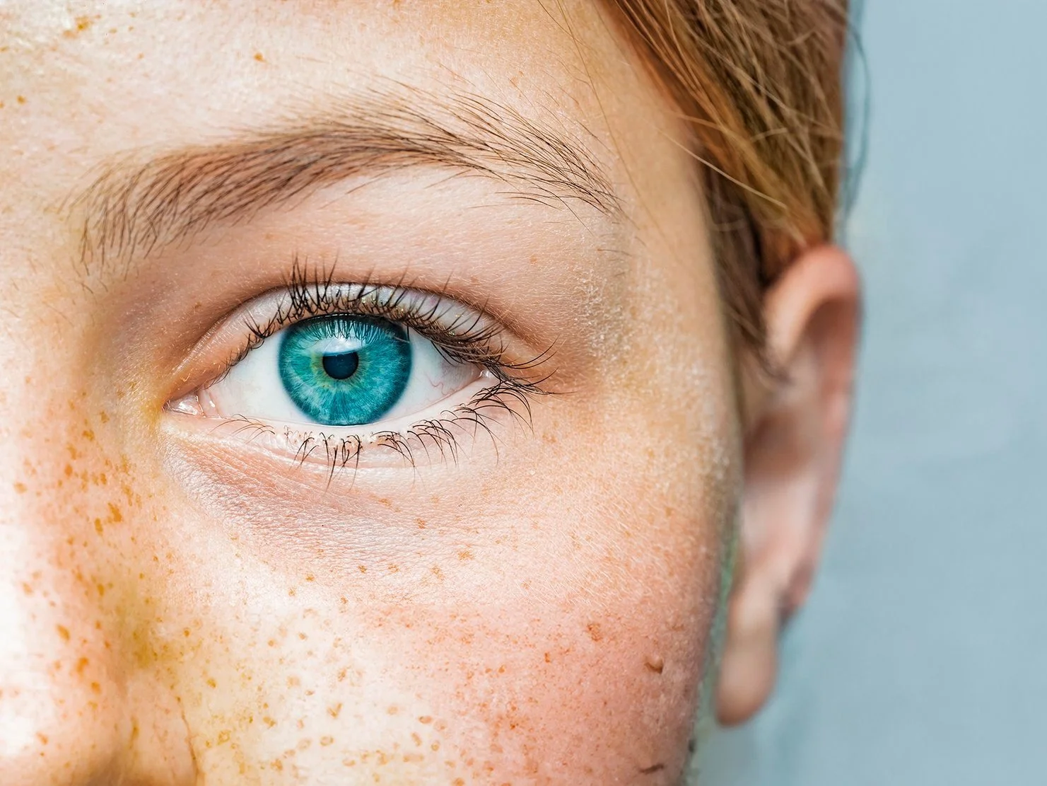 Laser Cataract Surgery | Focus Vision | Woolloongabba, QLD