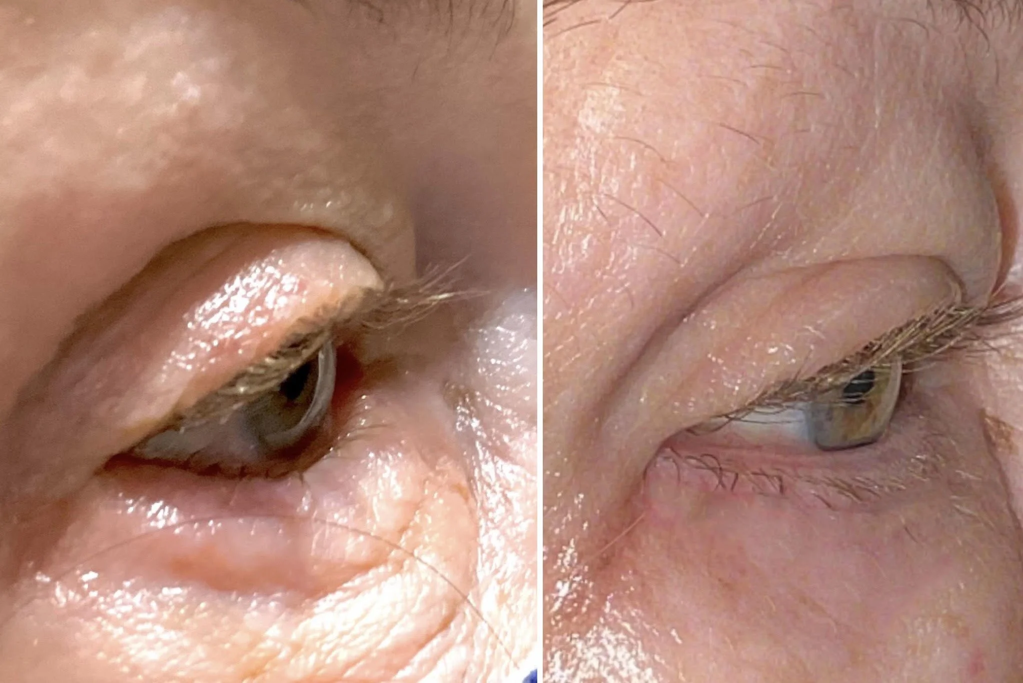 Our Instructors — Bellevue Eyelids