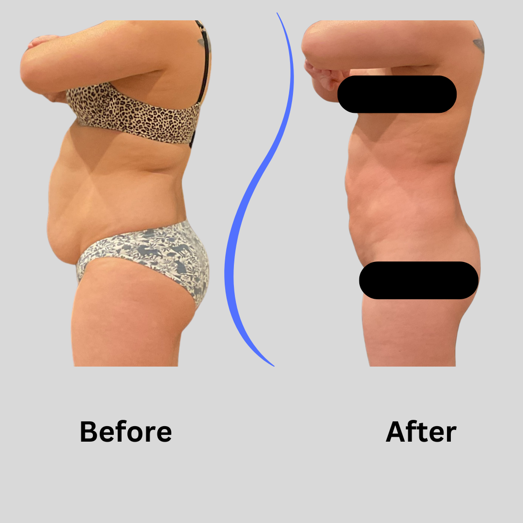 Blue Wolf Transformations