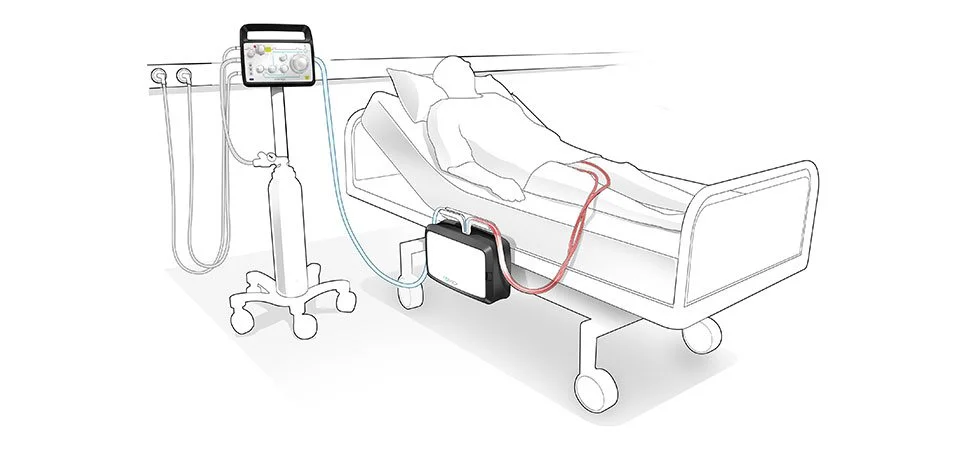InFlo Medical