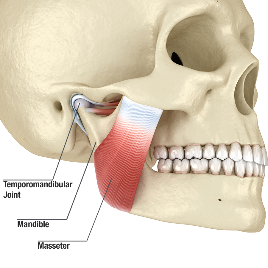 Pain TMJ Botox Treatments in Charlotte NC — Arboretum Center for Dentistry