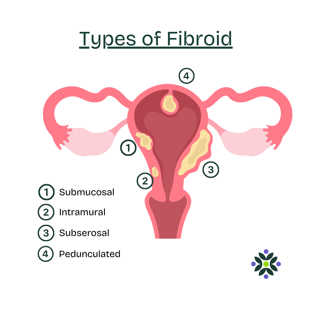 Fibroid Empowerment — TheDoctorRosemary