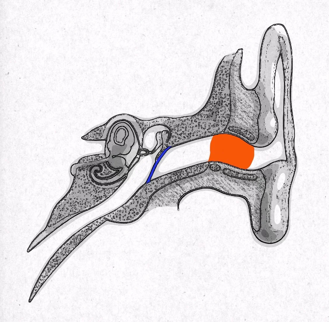 Ear Wax Nurse Titirangi and Remuera