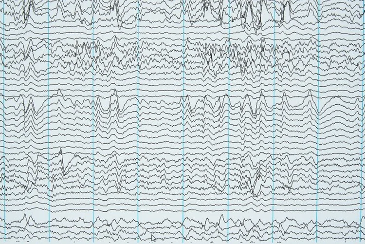 iSyncBrain — iMediSync Americas