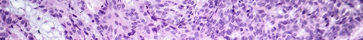 Goldfinch Laboratory | Expert Iowa Pathology Services