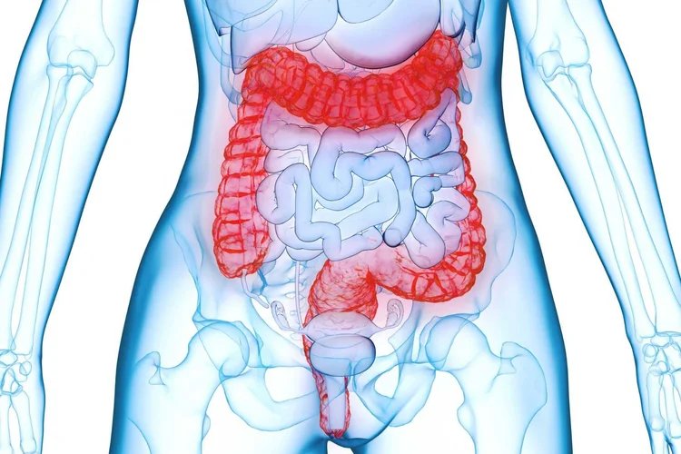 Open System Colonics vs. Closed: Key Differences
