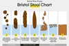 Bristol Stool Chart: What Healthy Poop Should Look Like — Fernz ...