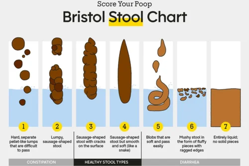 Bristol Stool Chart: What Healthy Poop Should Look Like — Fernz ...