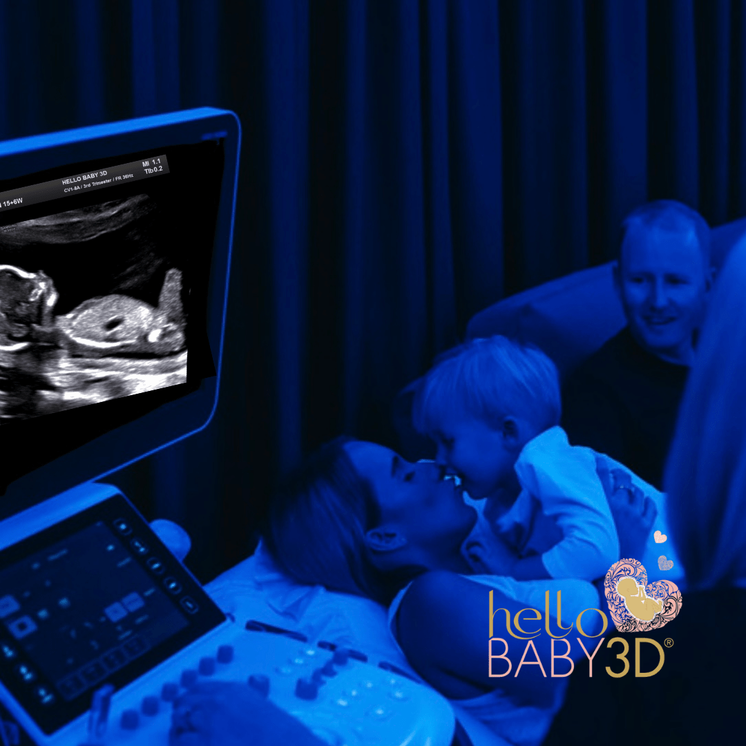 Gender Reveal Ultrasound