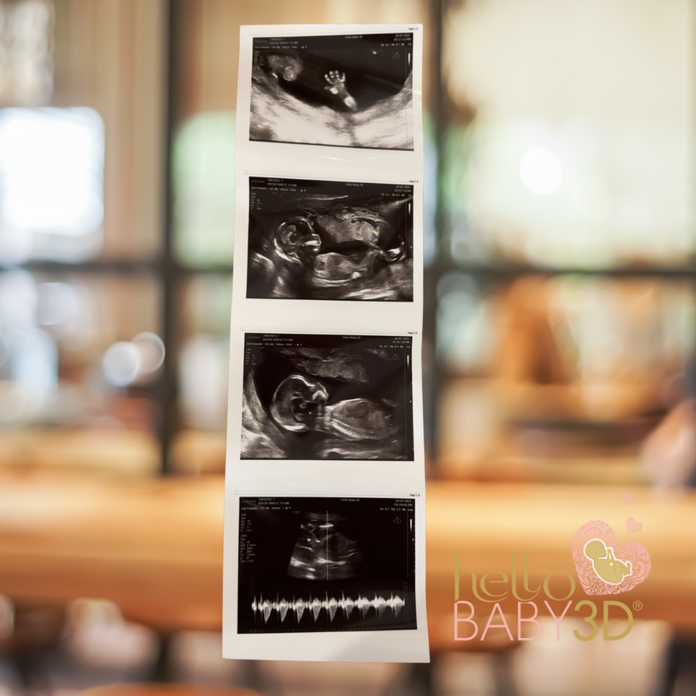 Reassurance 3D Pregnancy Ultrasound (7-13 Weeks) | Peace of Mind You ...