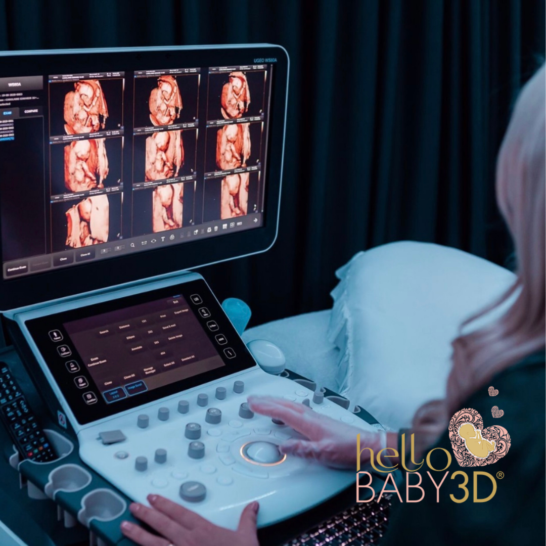 Reassurance 3D Pregnancy Ultrasound (14-19 Weeks) | Peace of Mind You ...