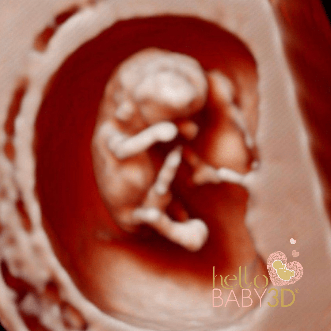 Reassurance 3D Pregnancy Ultrasound (7-13 Weeks) | Peace of Mind You ...