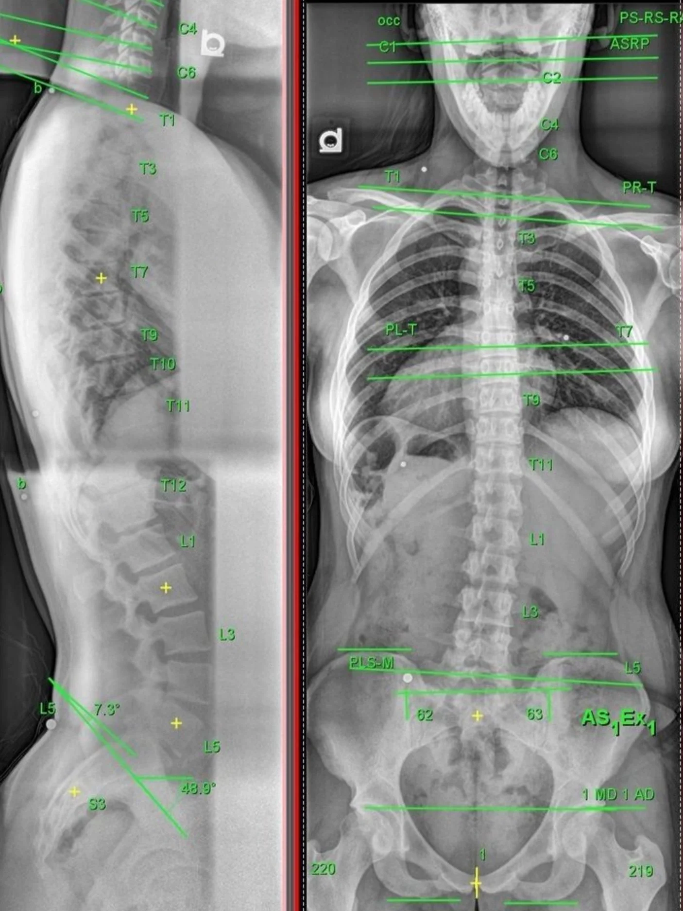 Shanghai Chiropractic | Gonstead Chiropractor in China