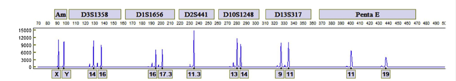 STR Analysis Explained — ANDE®