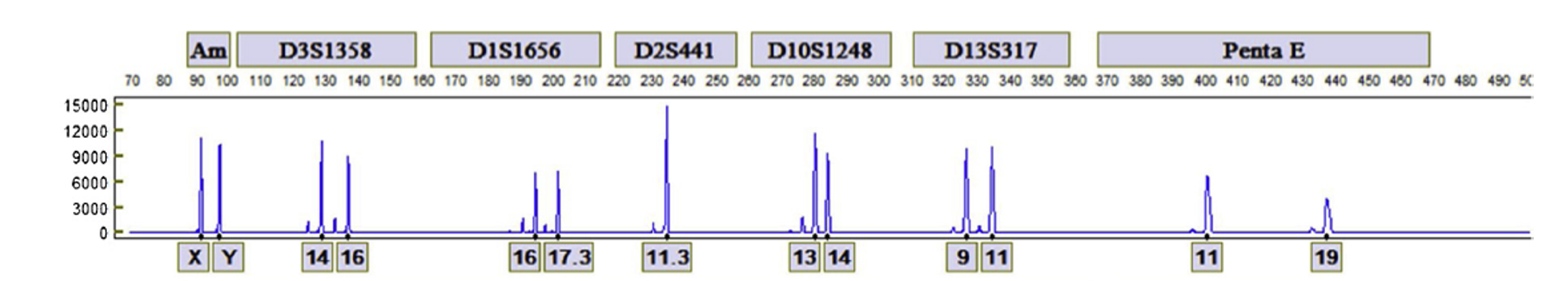 STR Analysis Explained — ANDE®