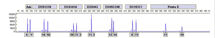 STR Analysis Explained — ANDE®