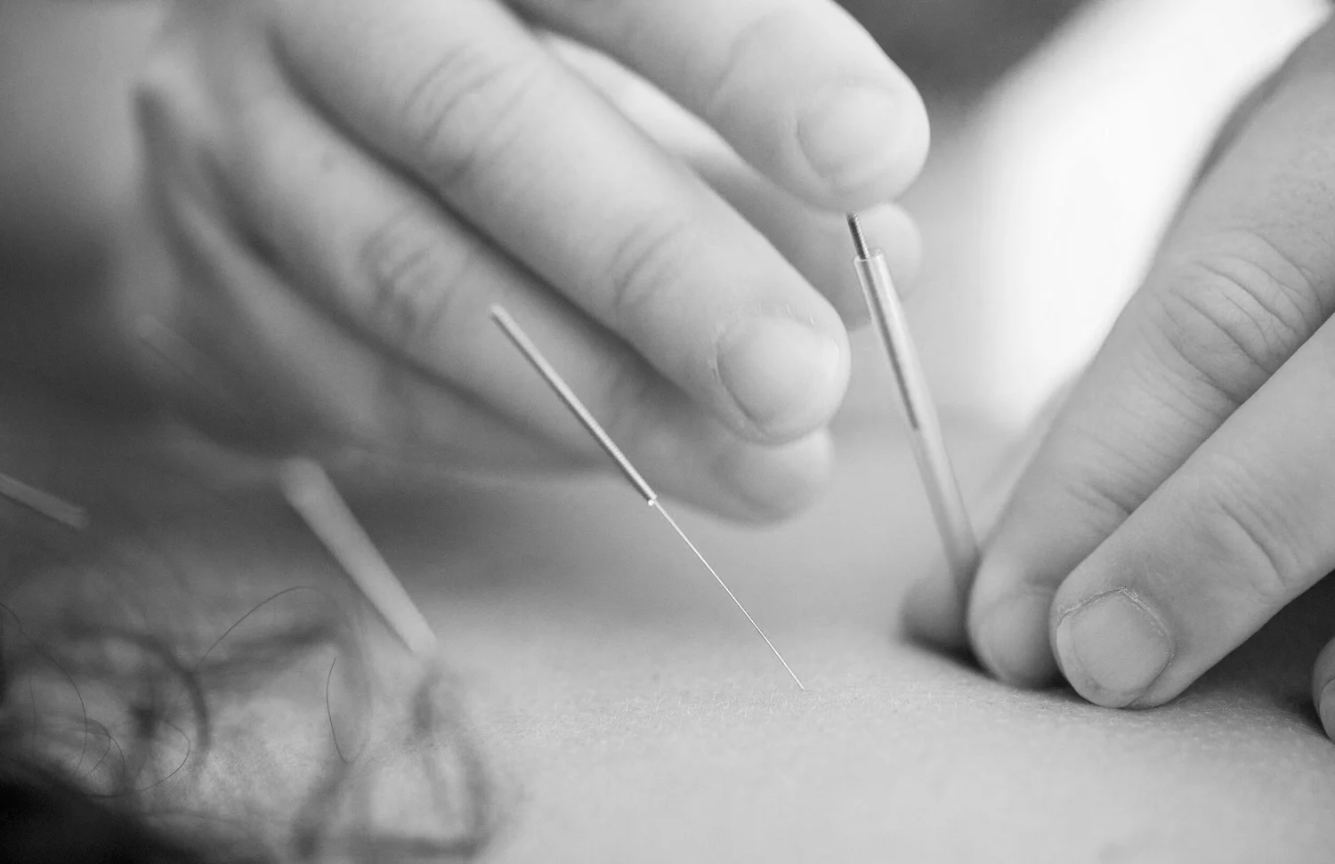 Dr. Jessica Chua | Specialist General Practitioner | Medical Acupuncturist
