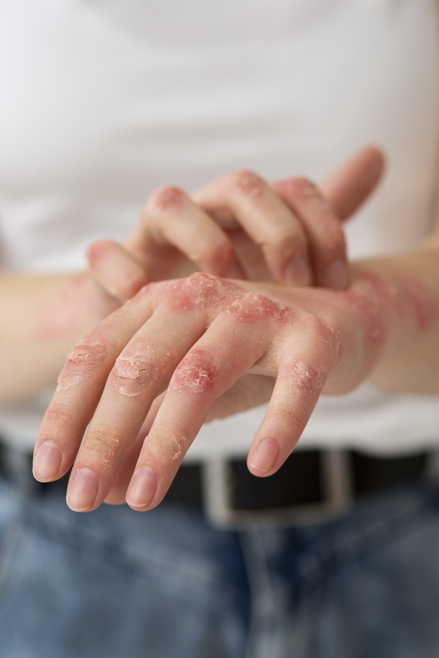 Sora Dermatology Lakewood