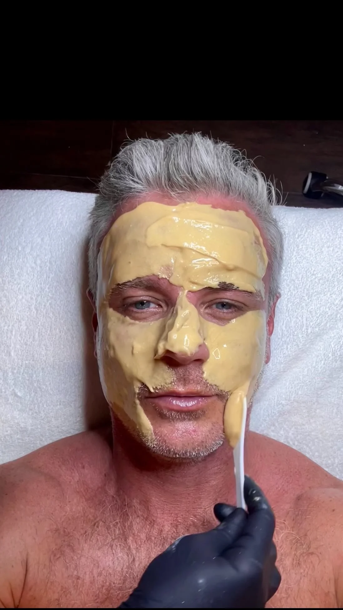 What Are Facial Extractions? An Essential Part of Your Facial Treatment ...