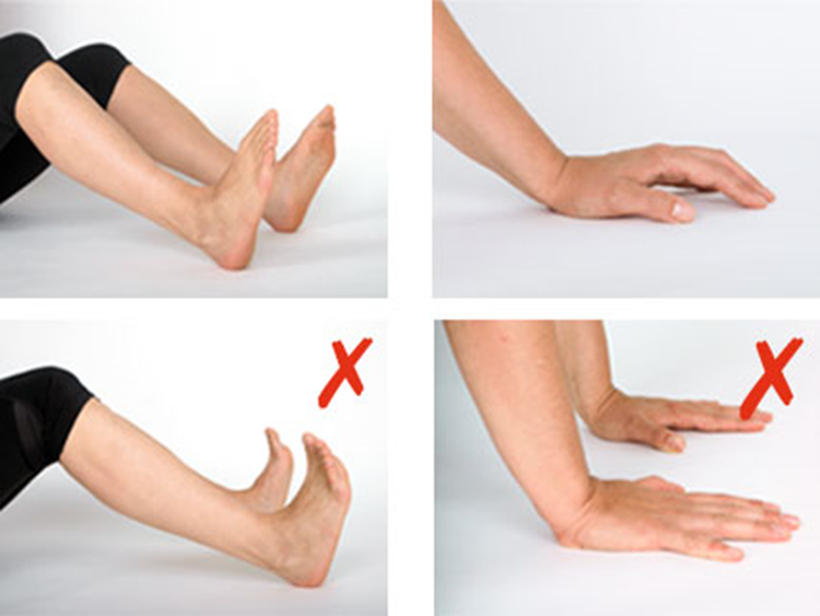 What is Brunkow: The Brunkow Story — Primitive Therapeutics