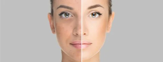 Common Benign Growths of the Face and What You Can Do About Them ...