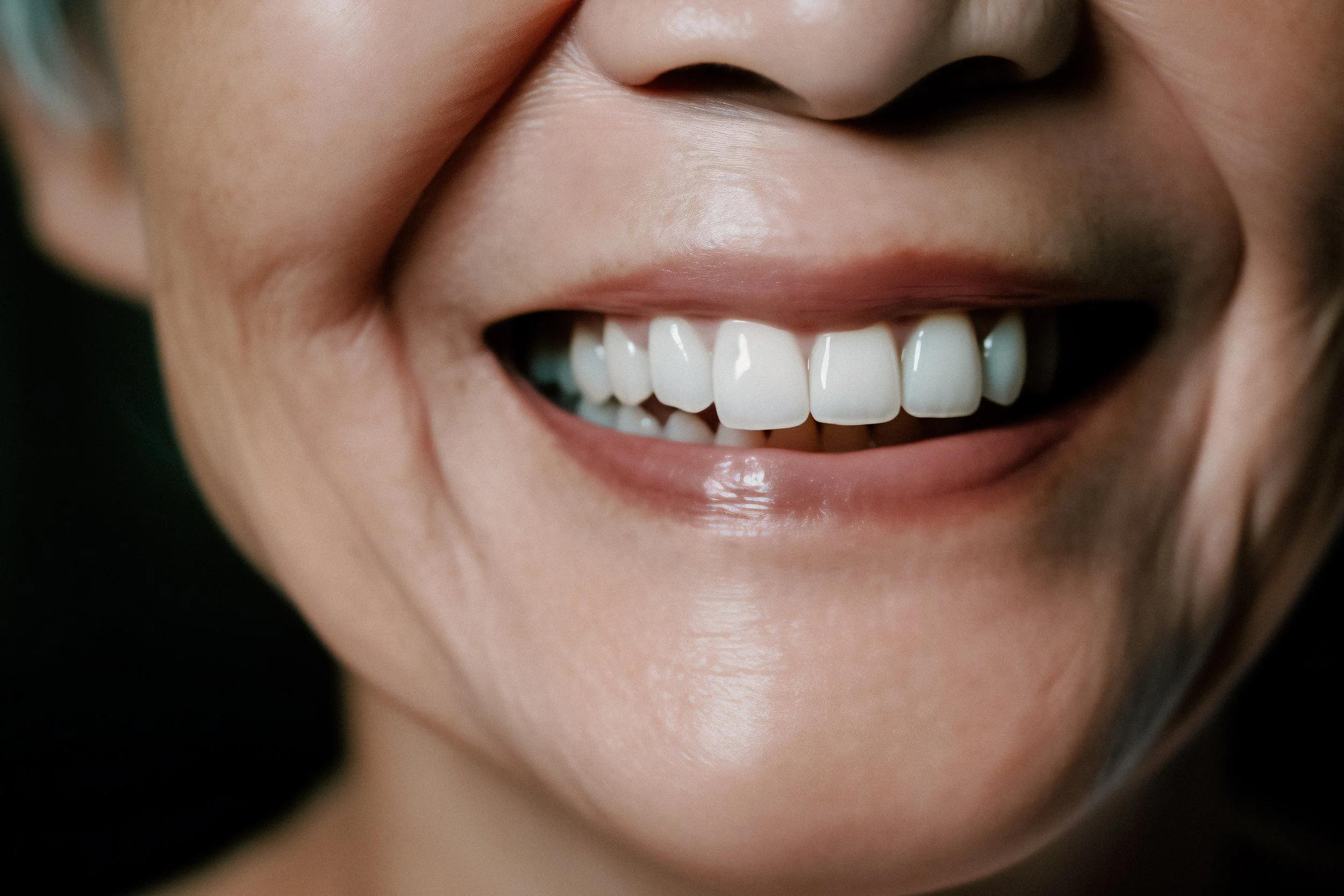 Dental Implants Services in Singapore | MediSave Claimable