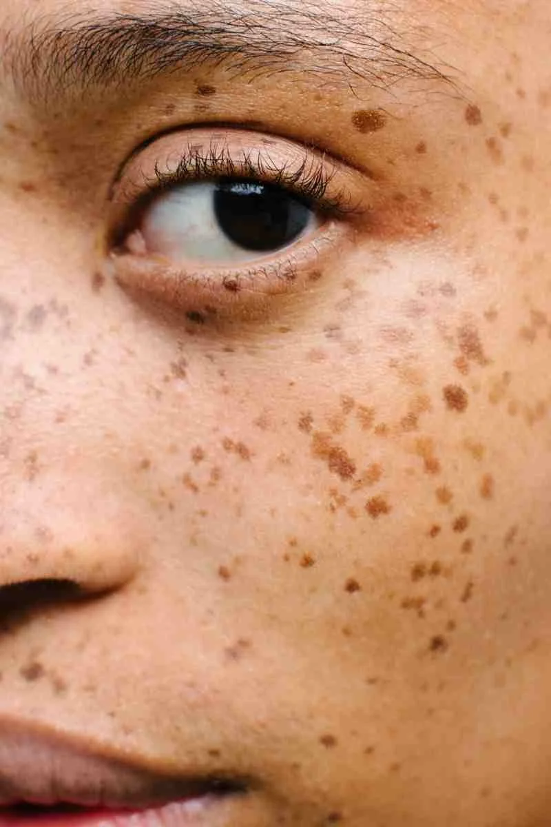 VAE Medical Aesthetics