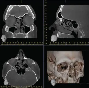 In-office CT Scanners — Tungsten Medical Network CBCT Scanners