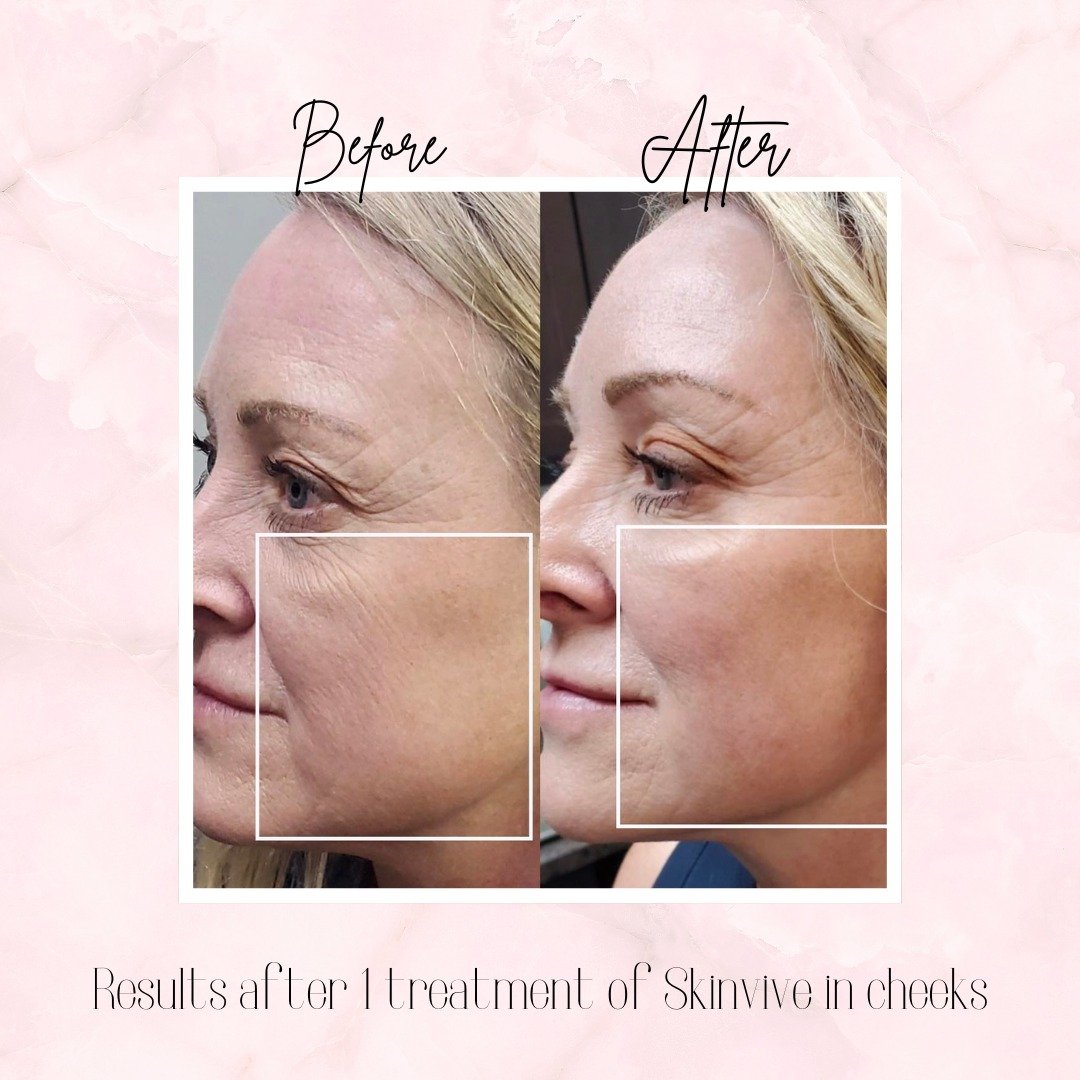 Red Deer Spa | Dermatologist Red Deer — Red Deer Medical Aesthetics Spa