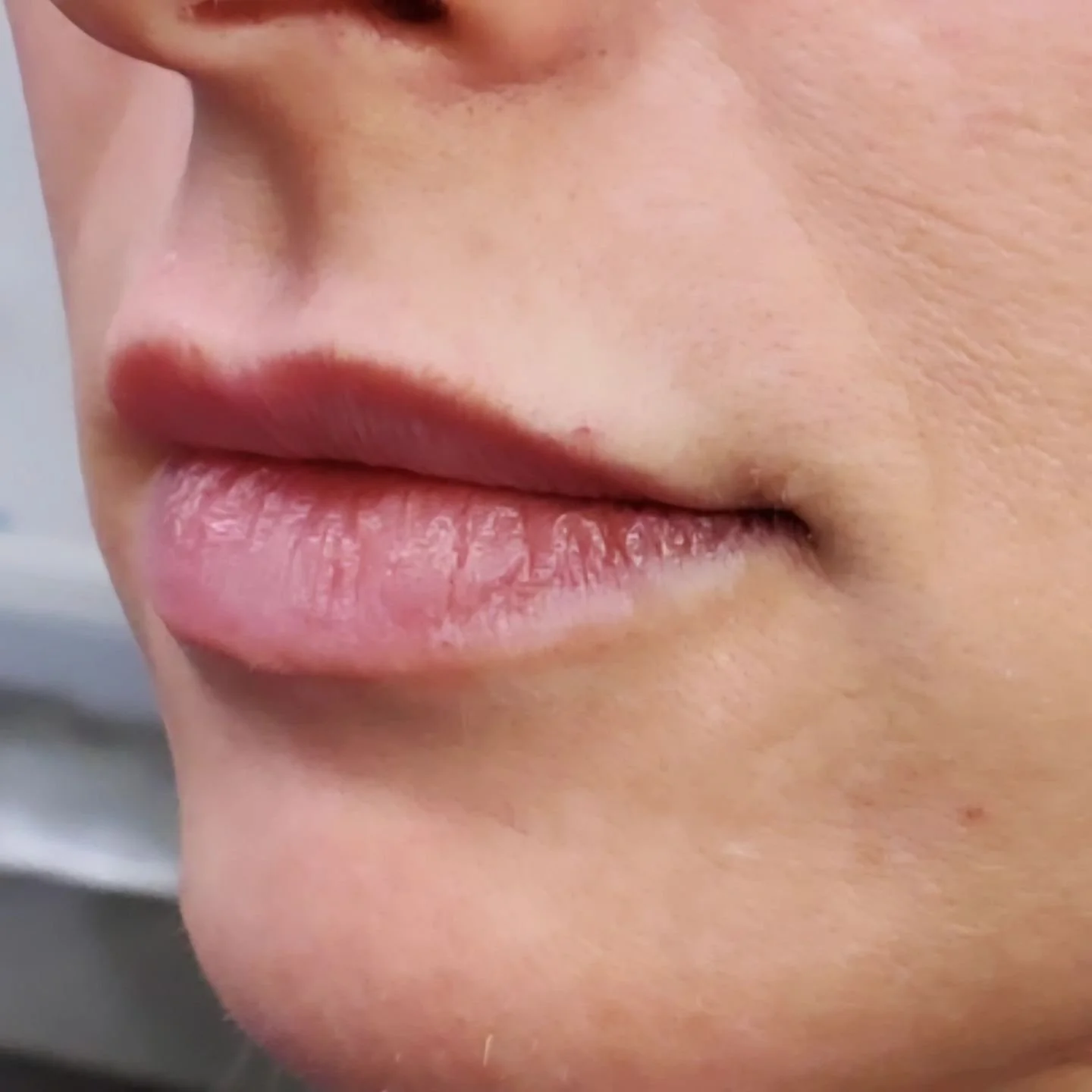 Red Deer Spa | Dermatologist Red Deer — Red Deer Medical Aesthetics Spa