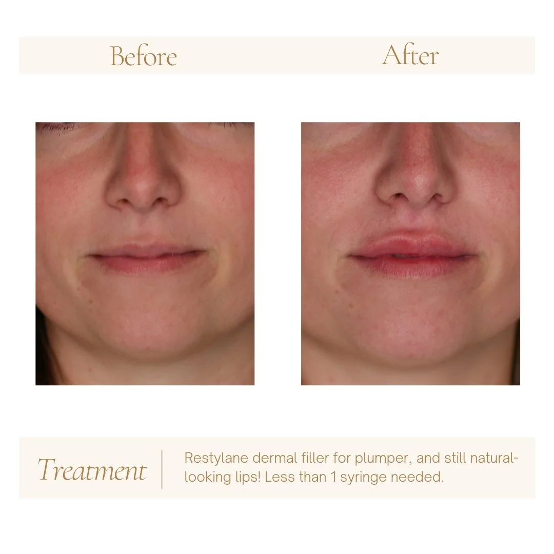 View Before & Afters | See Stunning Results – Book Your Transformation ...