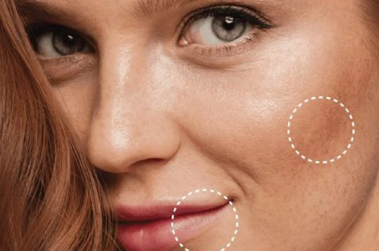 Cosmetic Injections — Serenity Mosman
