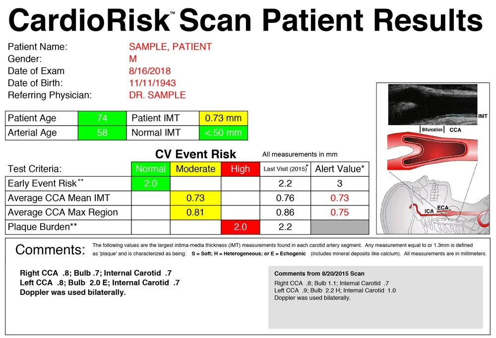 CIMT (Carotid Intima-Media Thickness) Test — Kadima Center for Heart ...