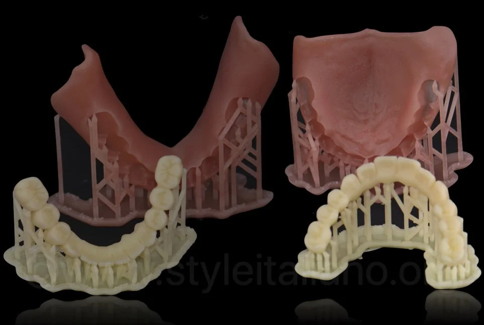 3D printed full dentures — Rodin Implants