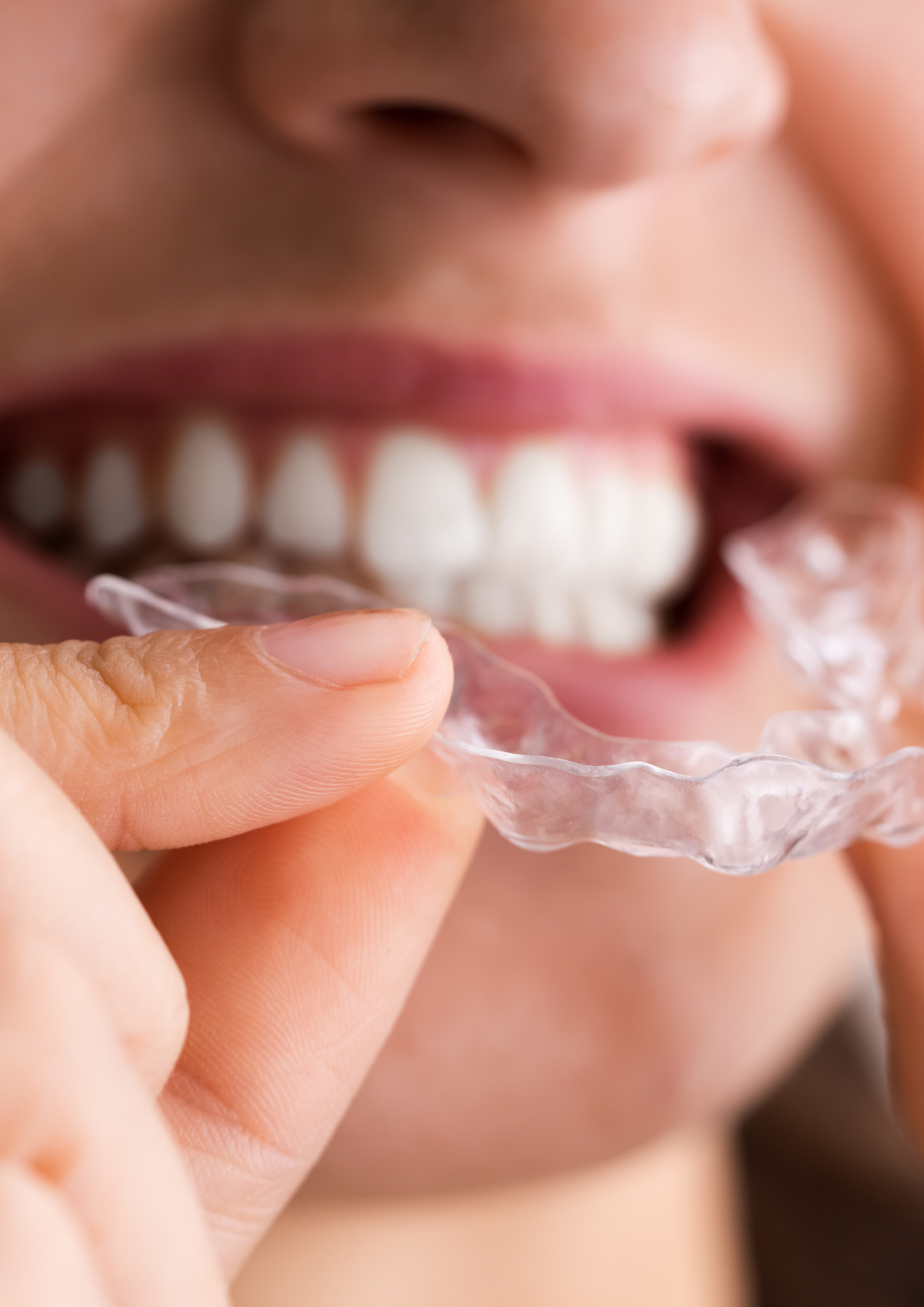 Preventive Dentistry — Artistic Dental Medicine