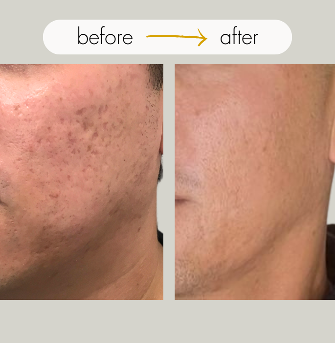 Advanced Aesthetic Treatments in Portland, Oregon: Experience Cutting ...