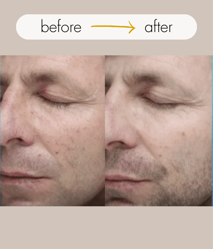 Smoother, Brighter Skin: Experience the Power of Portland's Best Laser ...