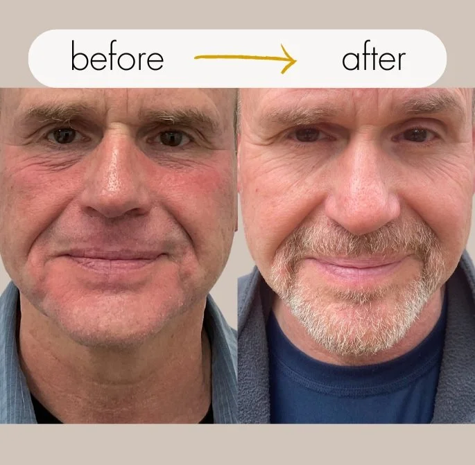 Smoother, Brighter Skin: Experience the Power of Portland's Best Laser ...