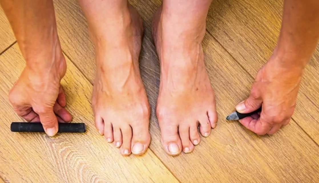 Moxibustion for Breech Presentation — MOONFLOWER Acupuncture & Herbal ...