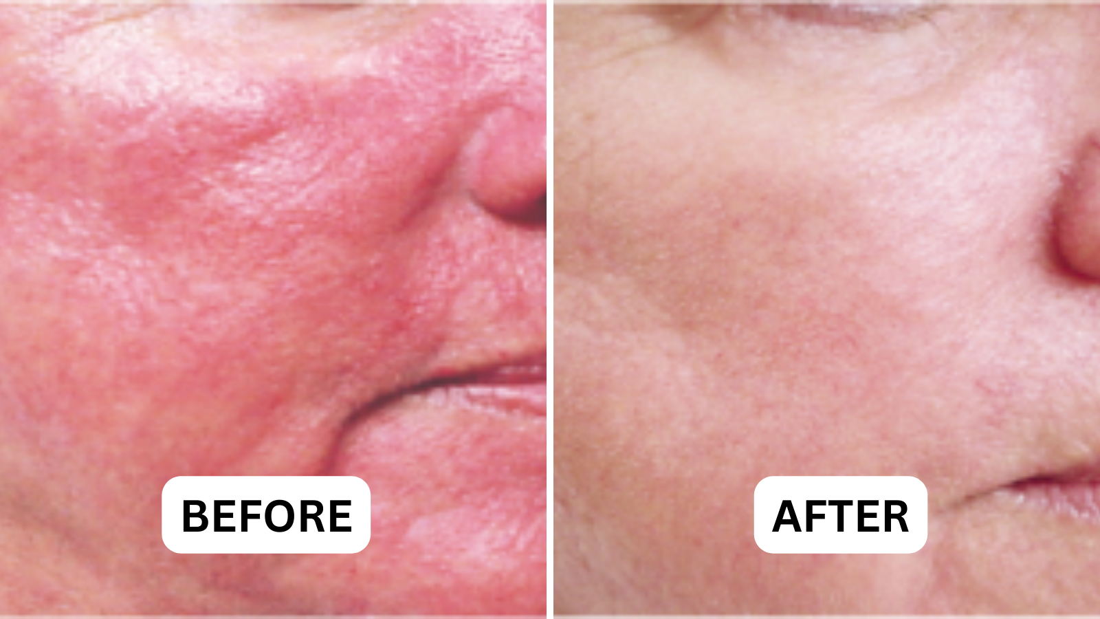 Services — Medical Laser and IPL Clinic