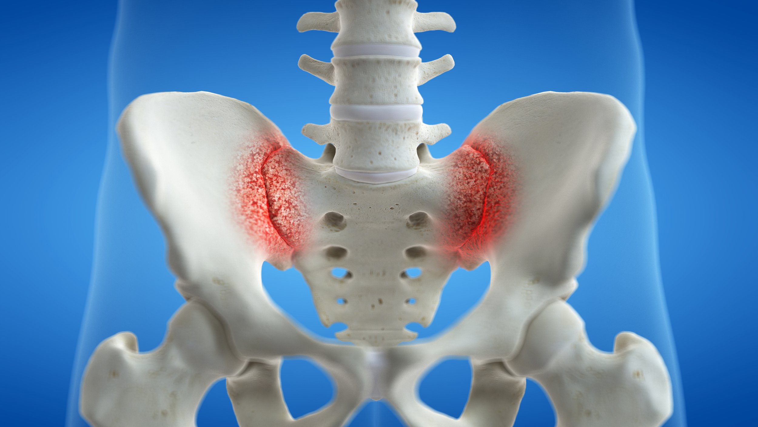 Sacroiliac Joint Dysfunction — JACQUELINE WEISBEIN, DO - PAIN ...