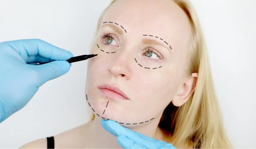 Achieving a Glamorous Look with a Full Facelift Surgery