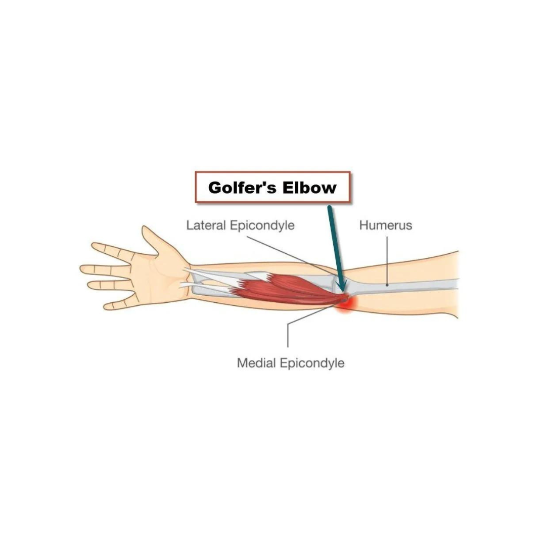 Preventing the 3 Most Common Golf Injuries — Dr. Quincy