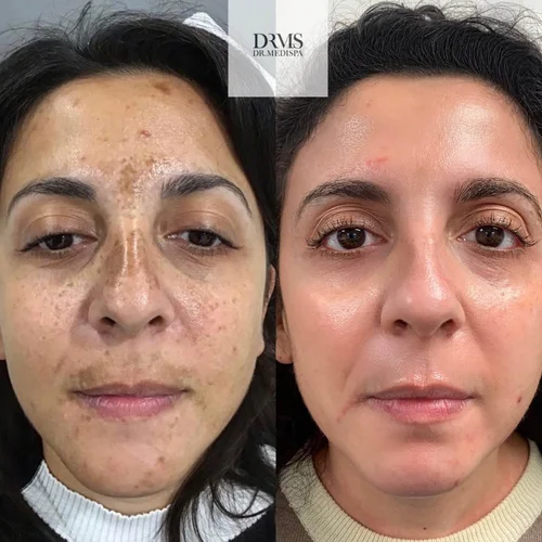 Skin Transformation Series — The Aesthetic List - Curated Directory