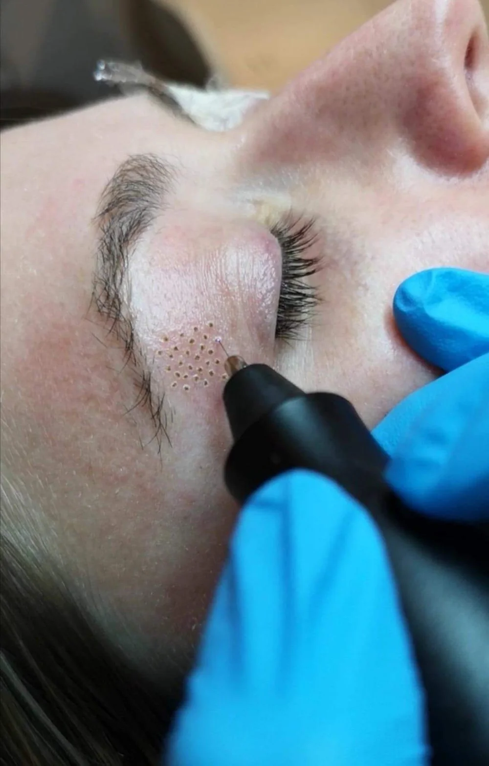 Edinburgh Permanent Makeup